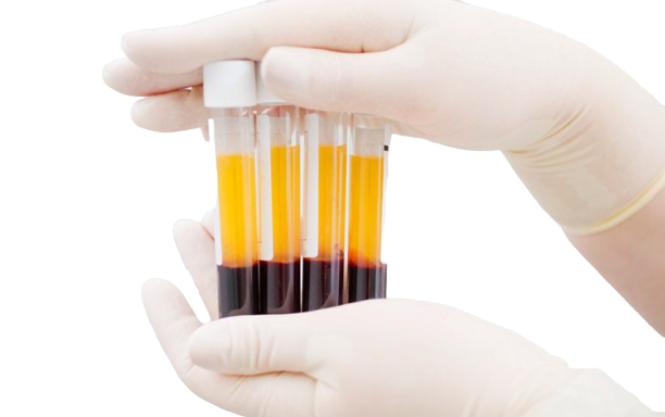 Combined PRP and Stem Cell - Top Rated Clinic for PRP in Kepong and KL